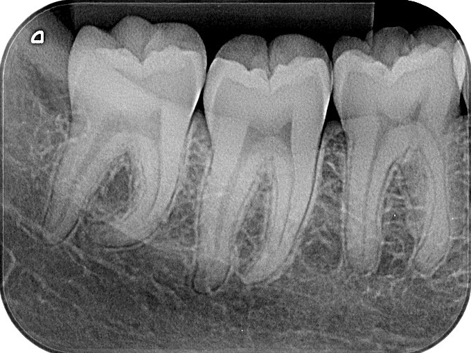 Springfield Smiles Family Dentistry TMJ & Sleep Center | Springfield OH